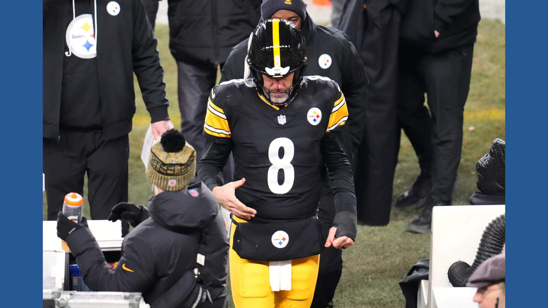 Aaron Rodgers' bloody nose a fitting symbol for the hurting Steelers in ...