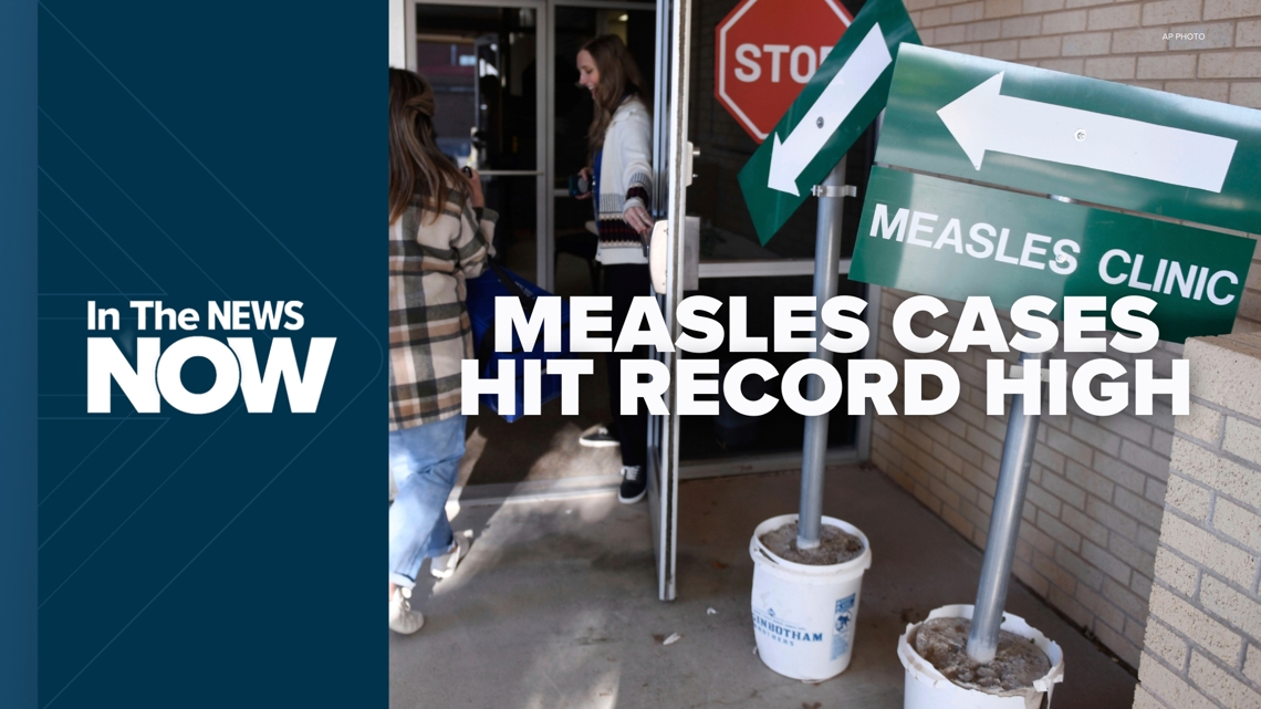 Measles cases in US hit 33-year high | In The News Now | abc10.com