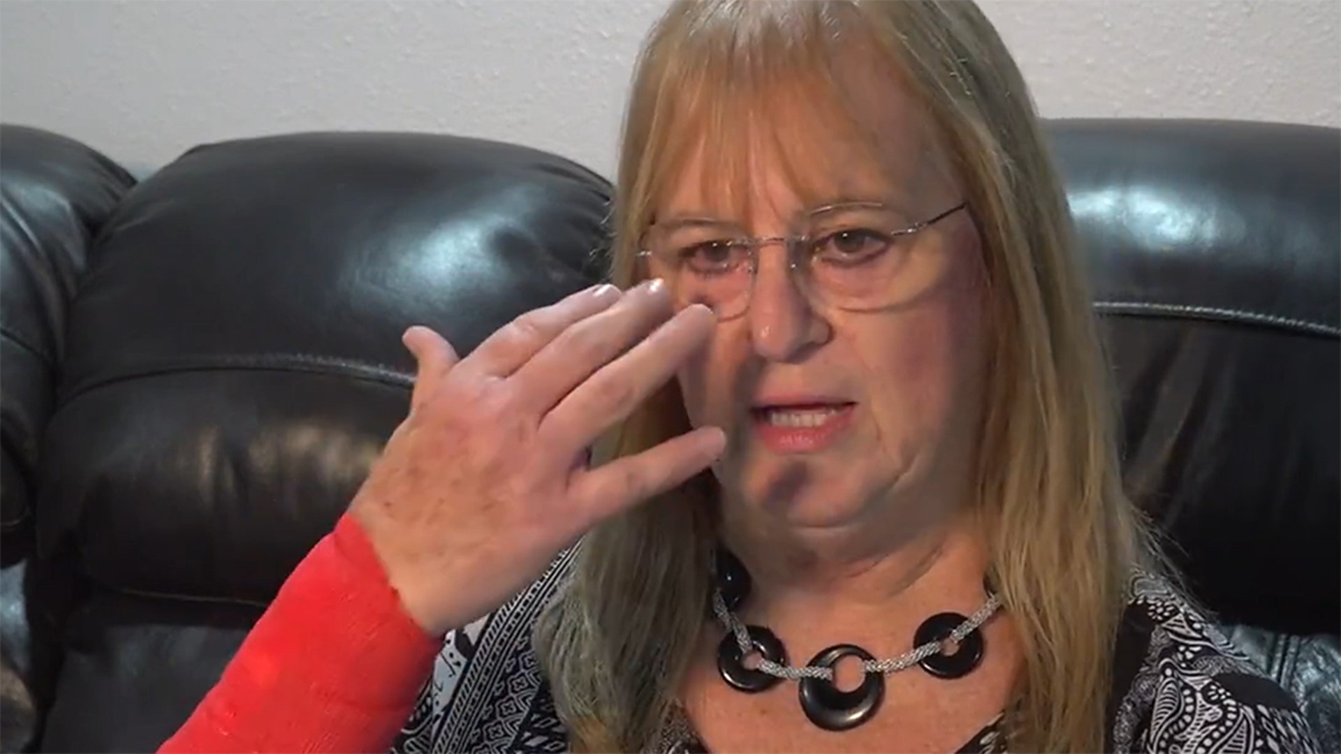 Texas woman attacked by snake and hawk at the same time | abc10.com