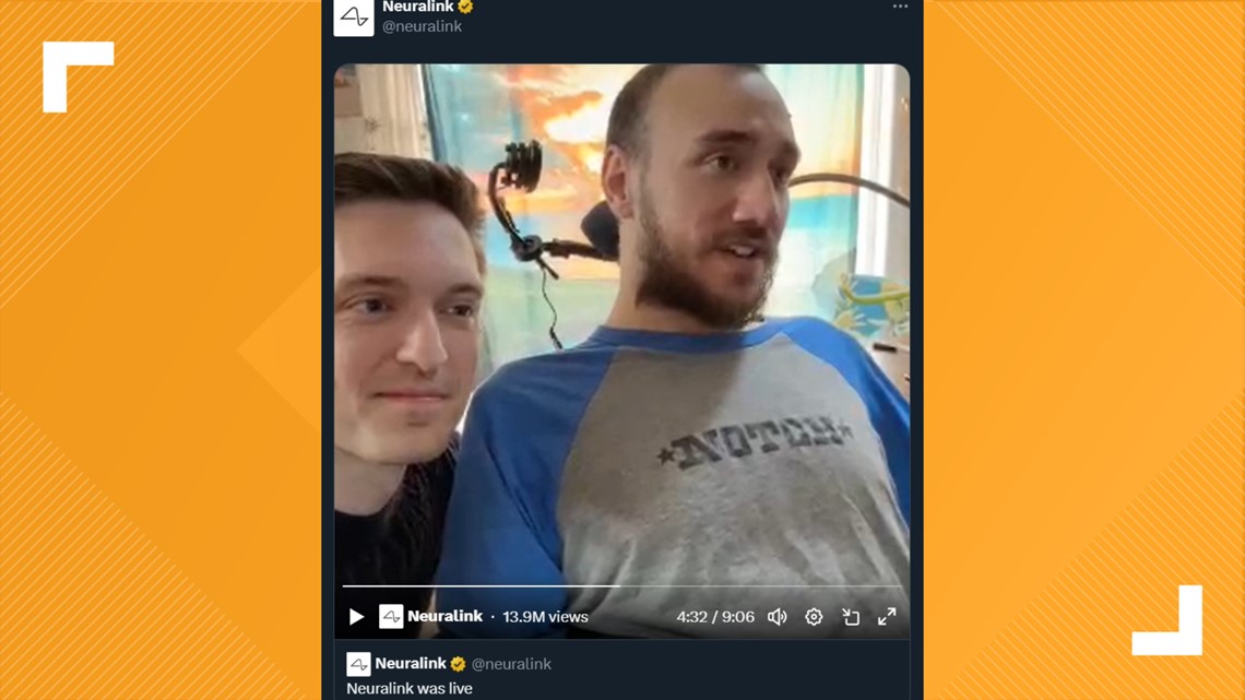 Neuralink's first clinical trial was a man from Arizona | abc10.com