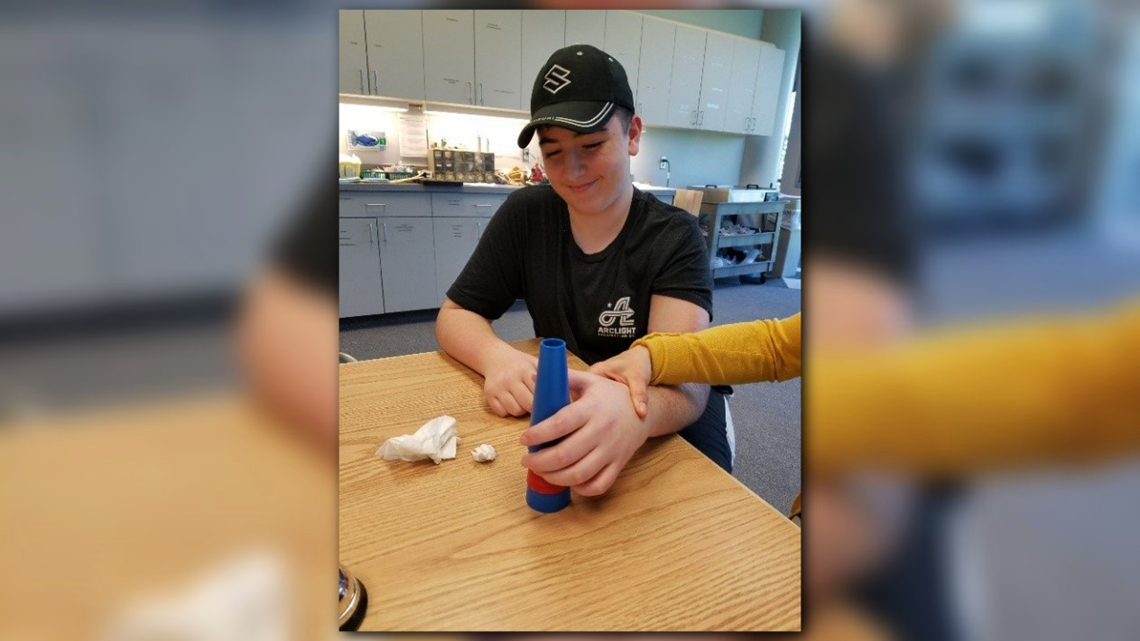 Teen's Left Arm Reattached After Accident That Nearly Killed Him ...