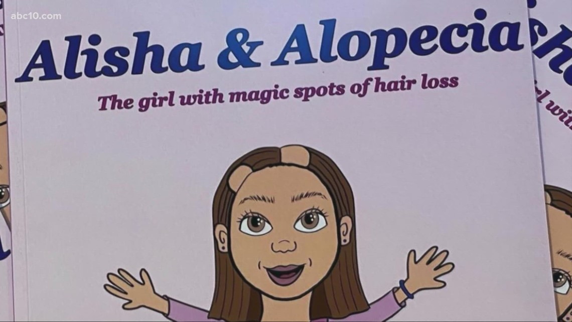 Roseville teen living with Alopecia writes book | abc10.com