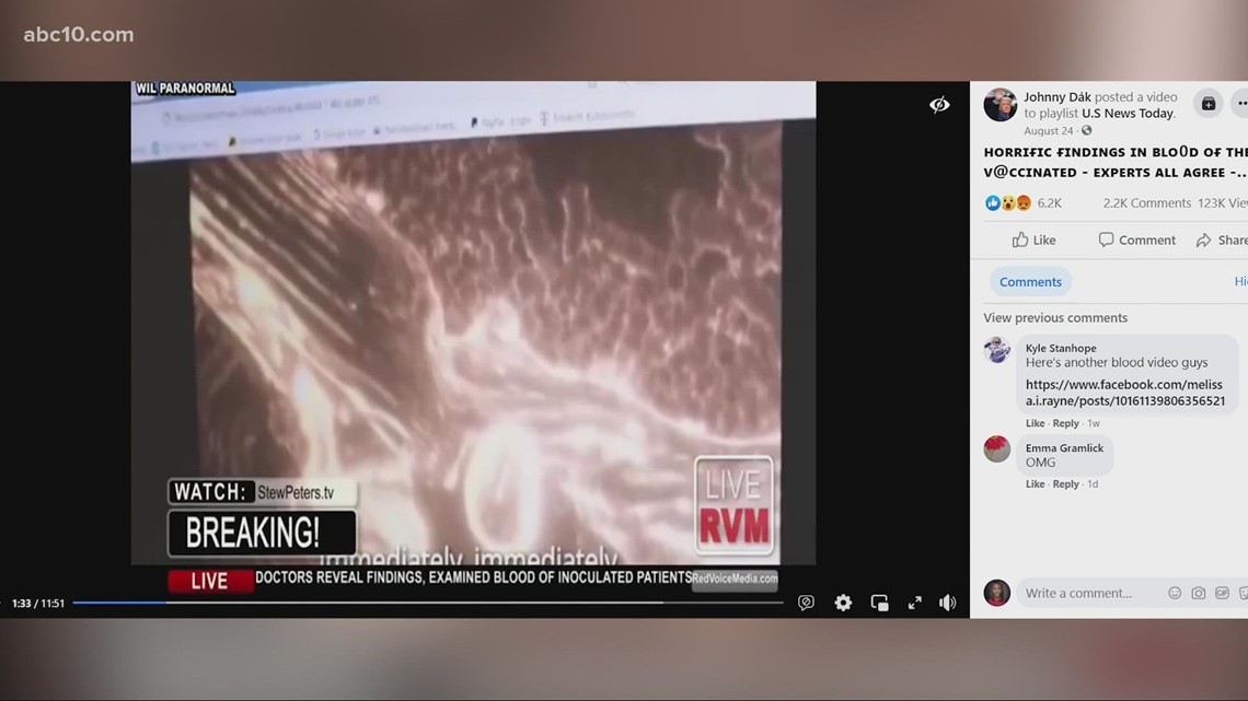 Video's claims on J&J vaccine and rouleaux are false | Verify | abc10.com