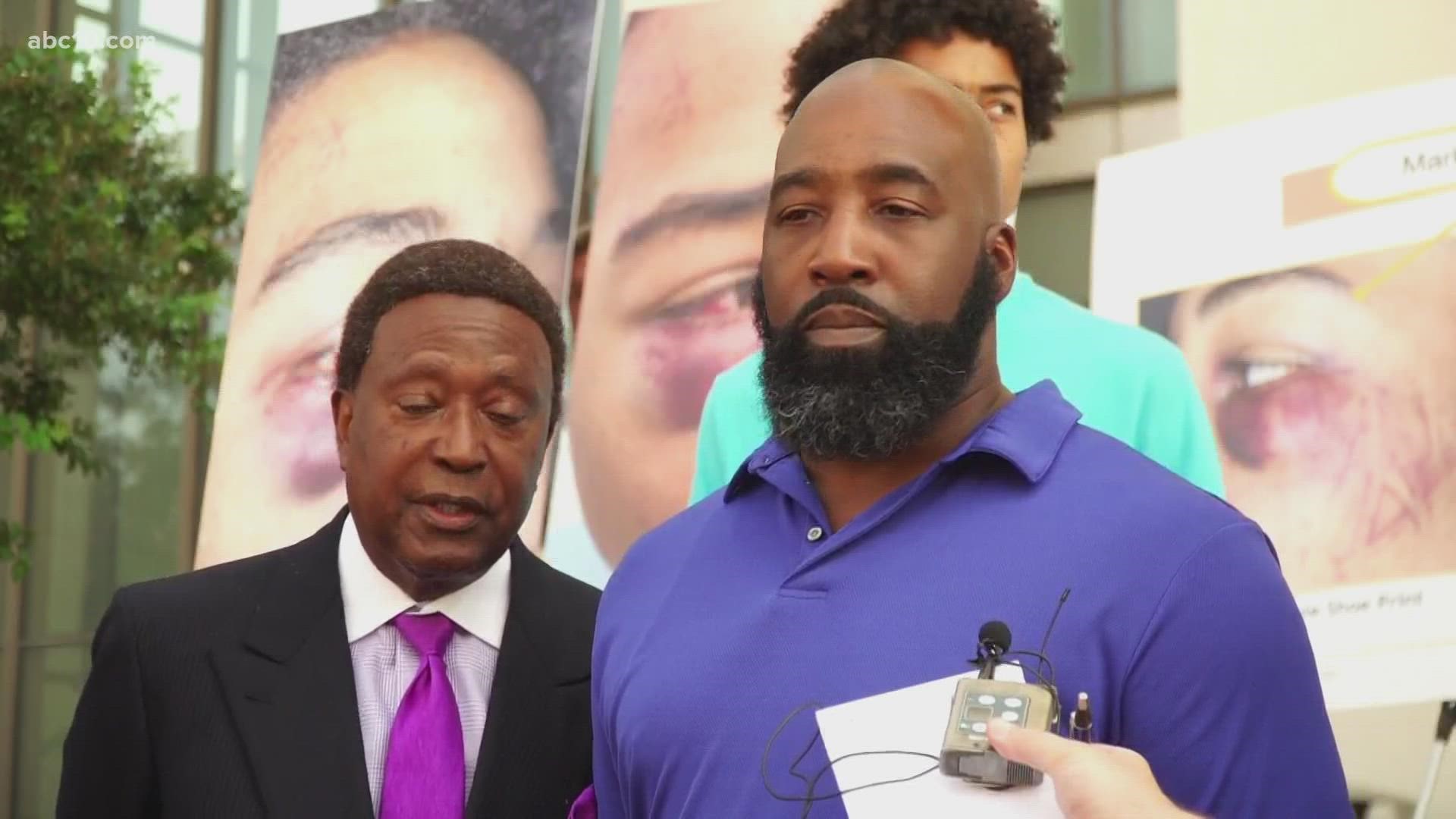 Sacramento County Sheriff's deputy Shauna Bishop charged for having sex ...