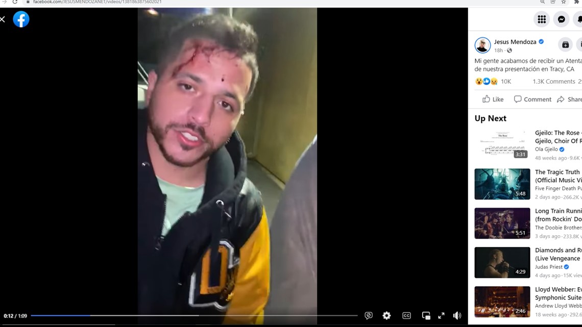 Mexican singer Jesus Mendoza attacked, robbed in Tracy | abc10.com