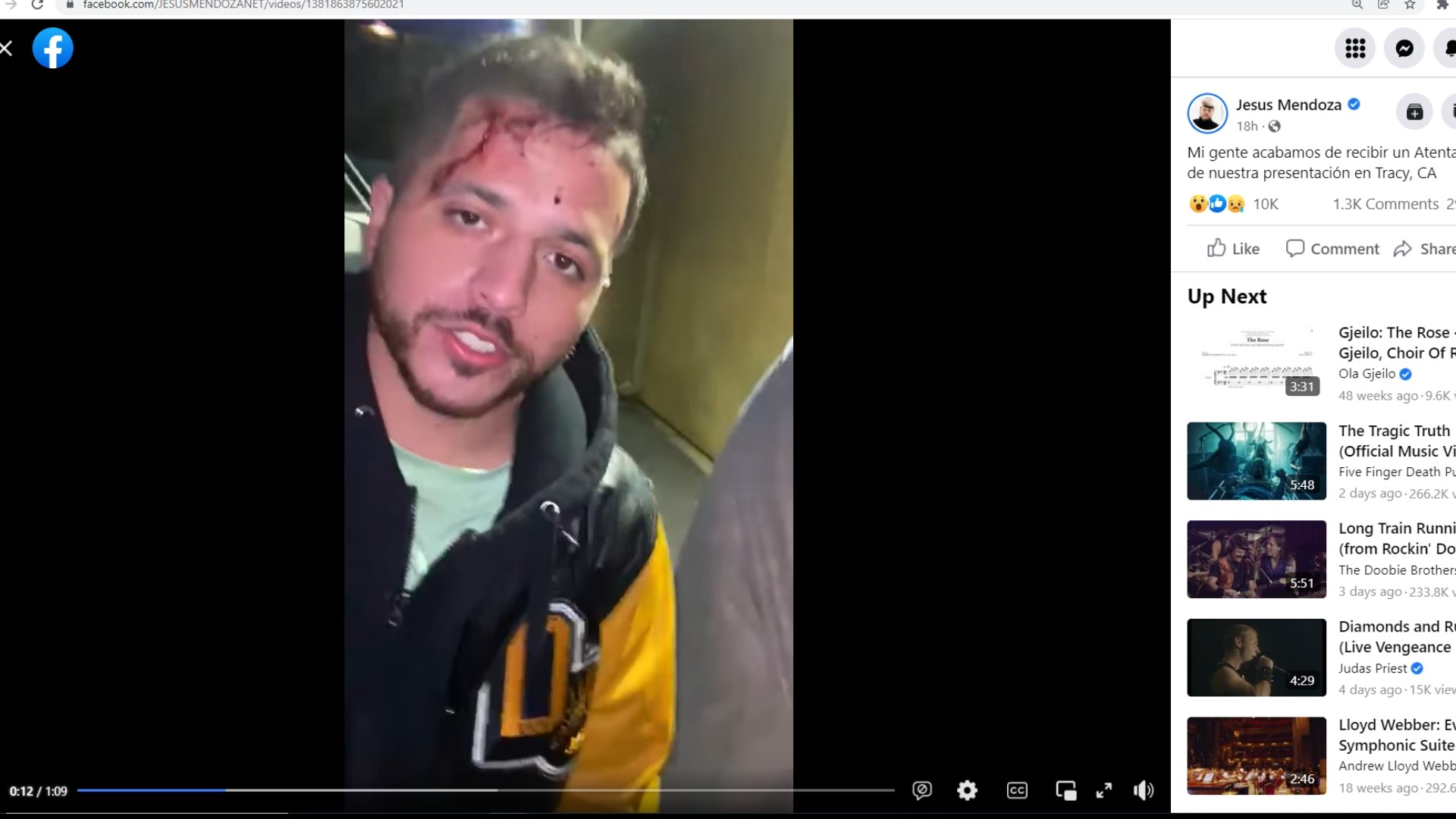 Mexican singer Jesus Mendoza attacked, robbed in Tracy | abc10.com