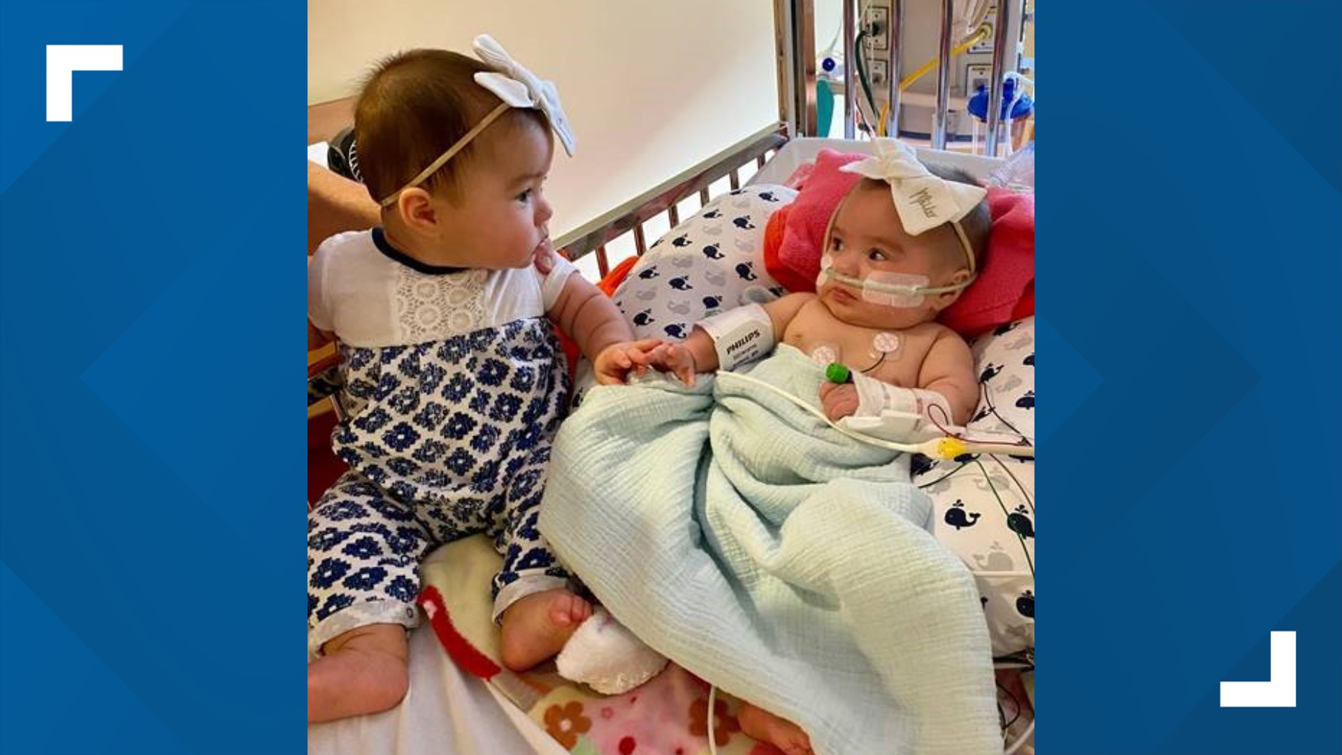 McCoy Twins at Children's in Atlanta lock eyes, hold hands | abc10.com
